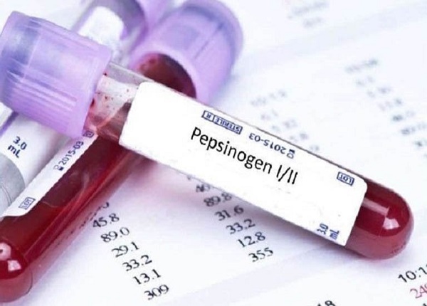Tầm quan trọng của xét nghiệm Pepsinogen trong phát hiện sớm ung thư dạ dày